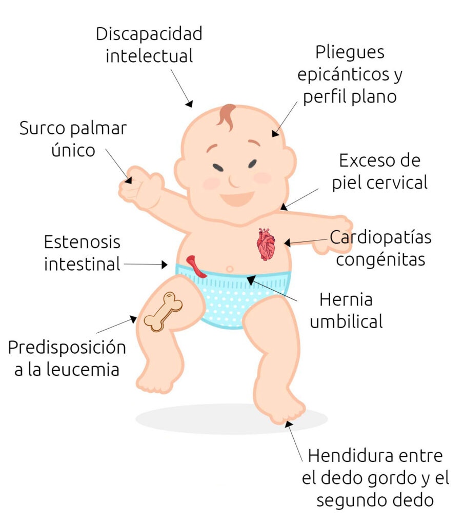 Celebramos el Día Mundial del Síndrome de Down - Instituto Raimon Gaja